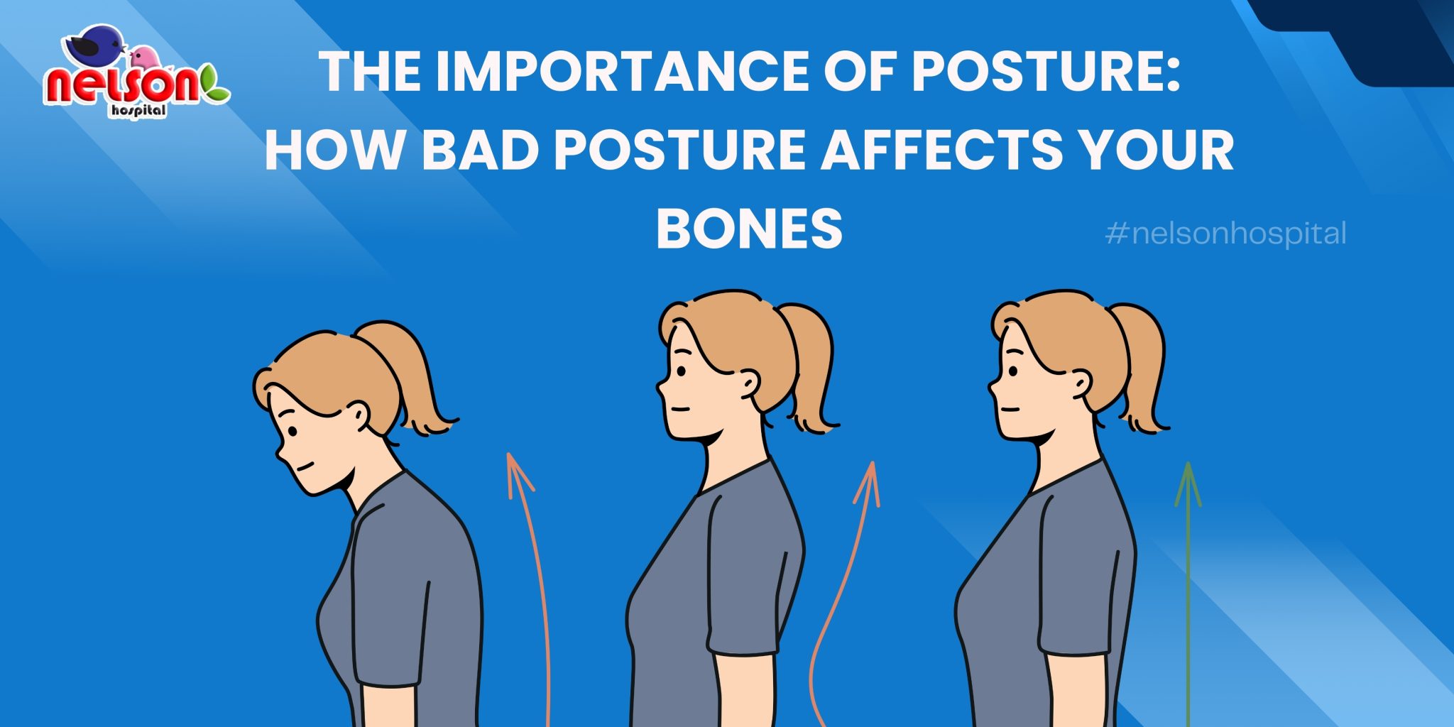 How Bad Posture Affects Your Bones
